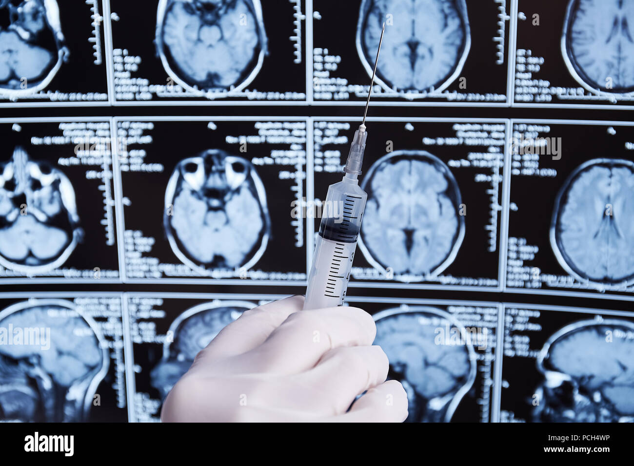 Magnetic resonance scan of the brain. MRI. Syringe in hand Stock Photo ...