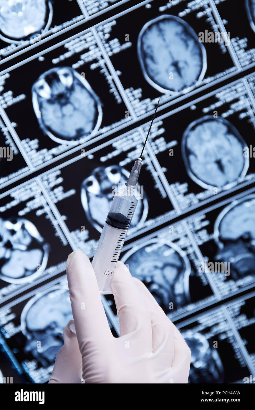 Magnetic resonance scan of the brain. MRI. Syringe in hand Stock Photo ...