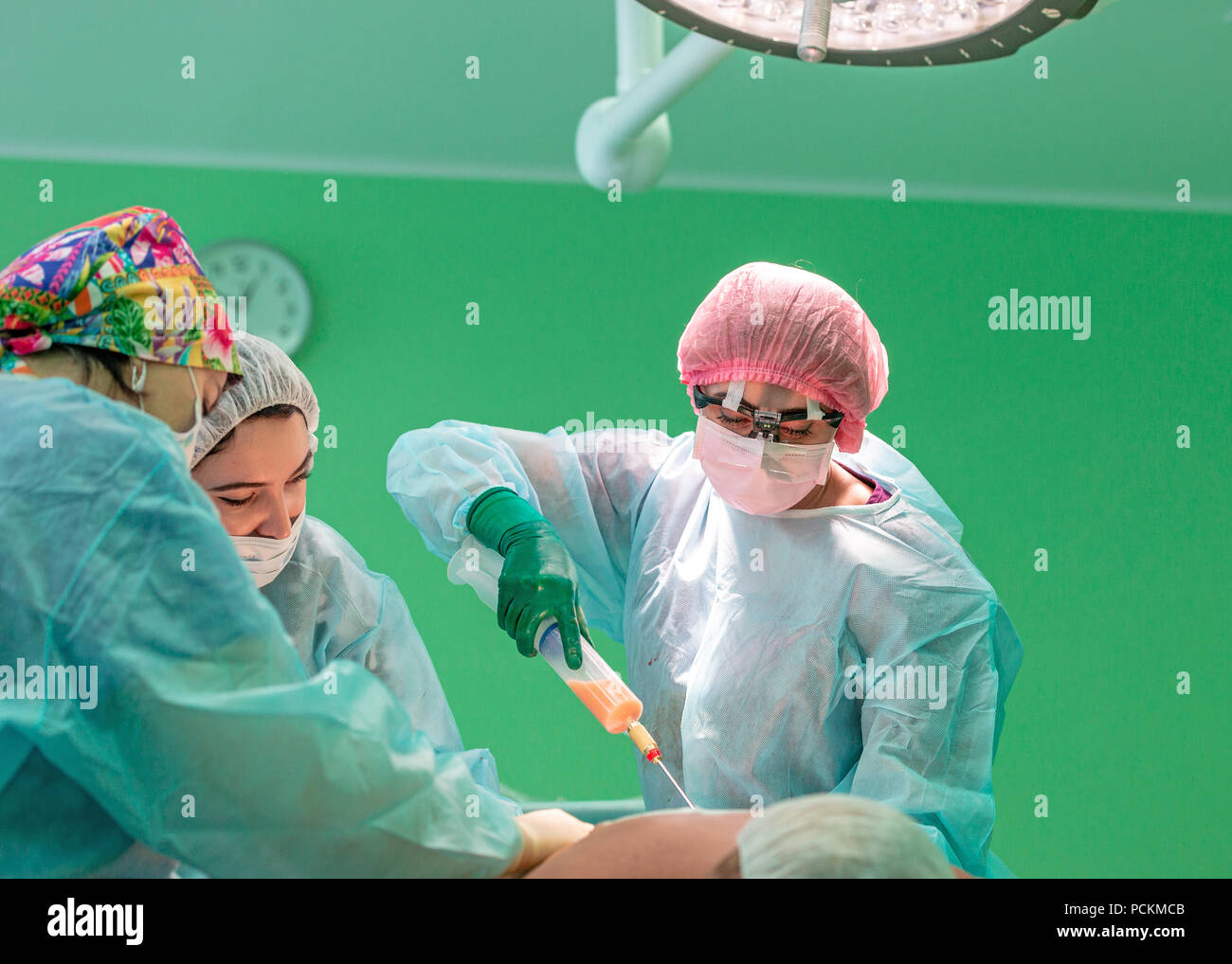 cosmetic liposuction surgery in actual operating room, group of ...