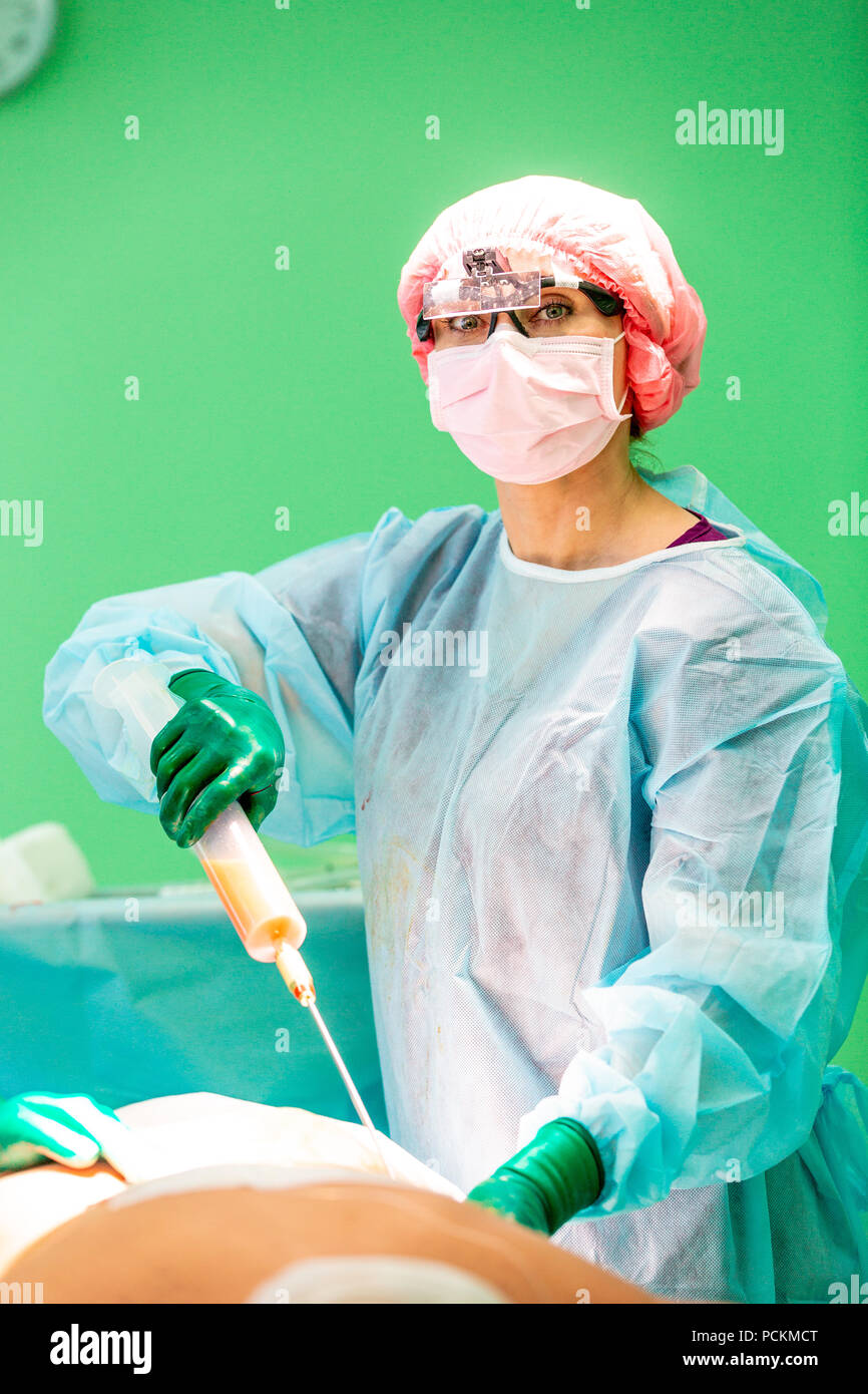 cosmetic liposuction surgery in actual operating room, group of ...