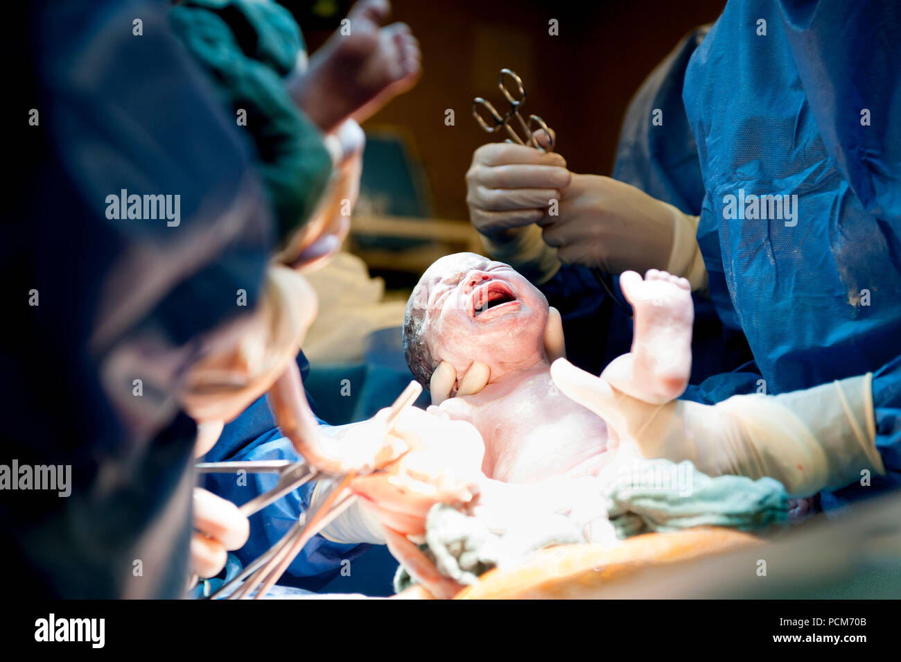 A woman giving birth to twins by caesarean section (Heverlee, 30/12 ...
