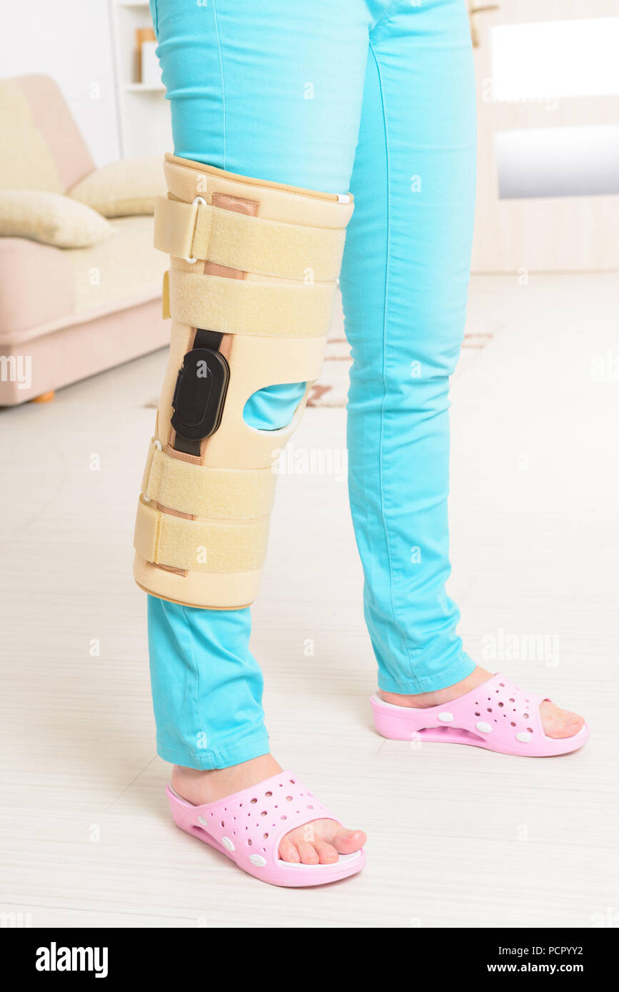 Woman's leg in knee cages for stabilization and support Stock Photo - Alamy