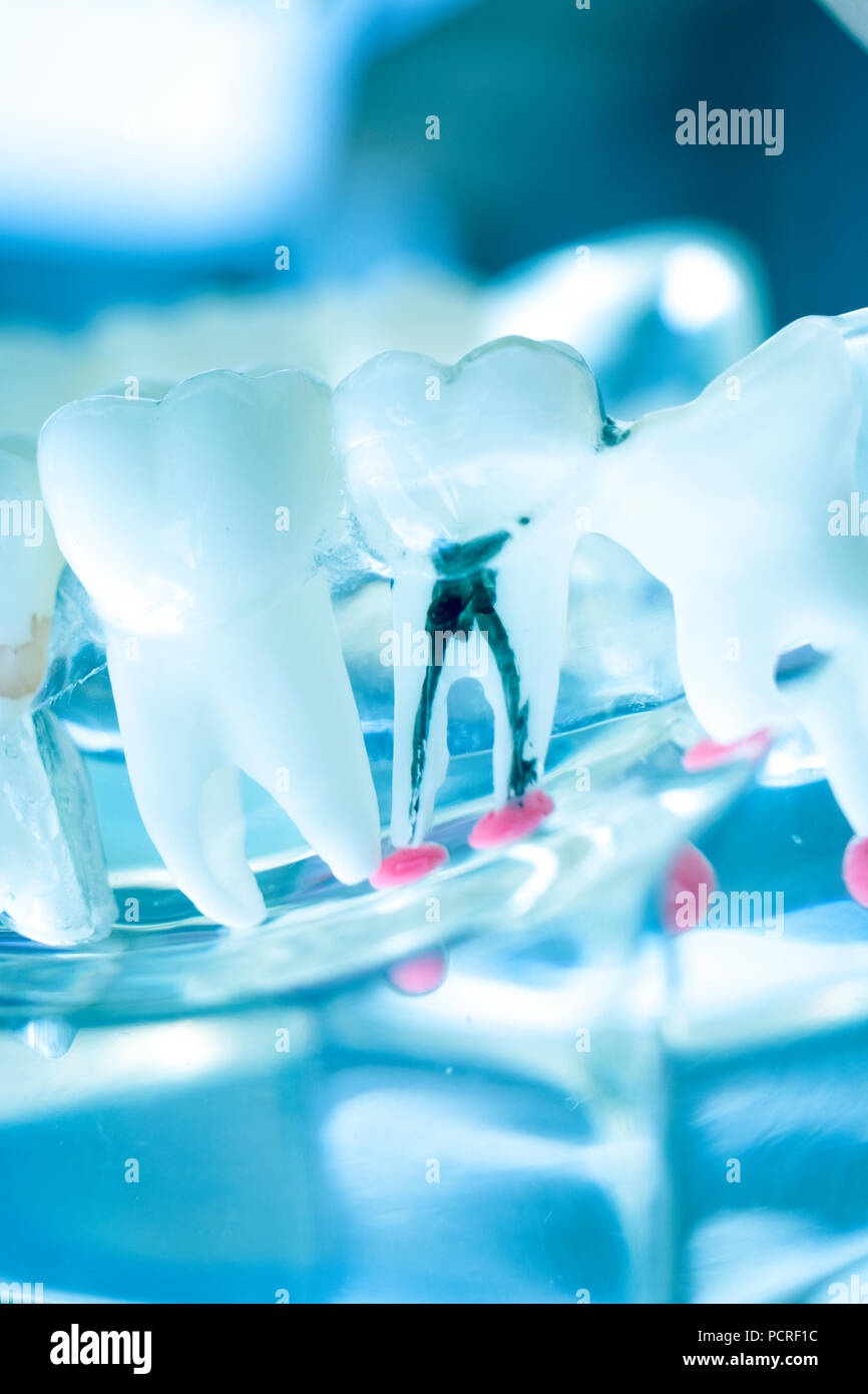 Dentist dental teeth teaching model showing each tooth and gum for ...