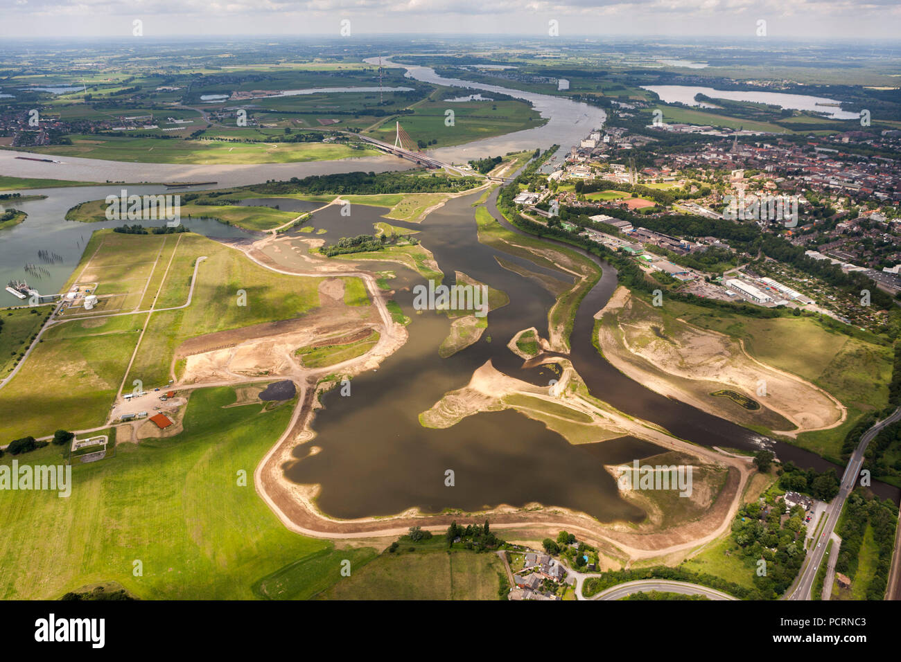 Reconstruction of lippe mouth by lippeverband hi-res stock photography ...
