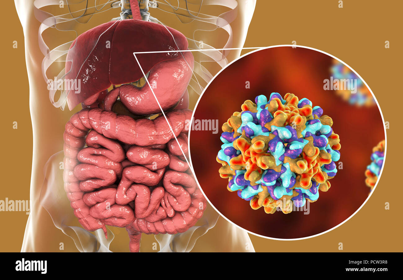 Hepatitis B infection. Computer illustration showing liver and close-up ...