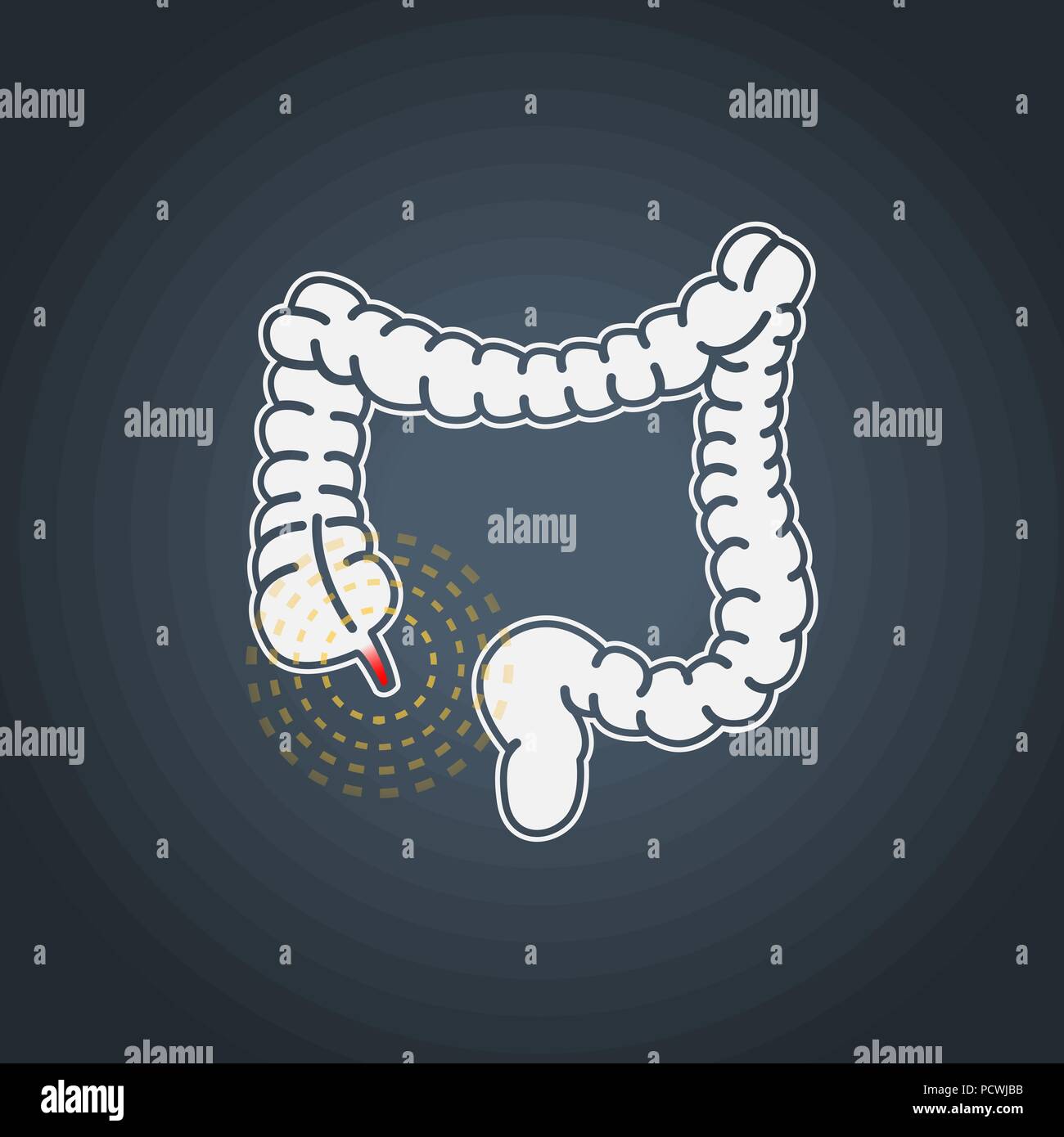 Appendicitis vector logo icon illustration Stock Vector Image & Art - Alamy