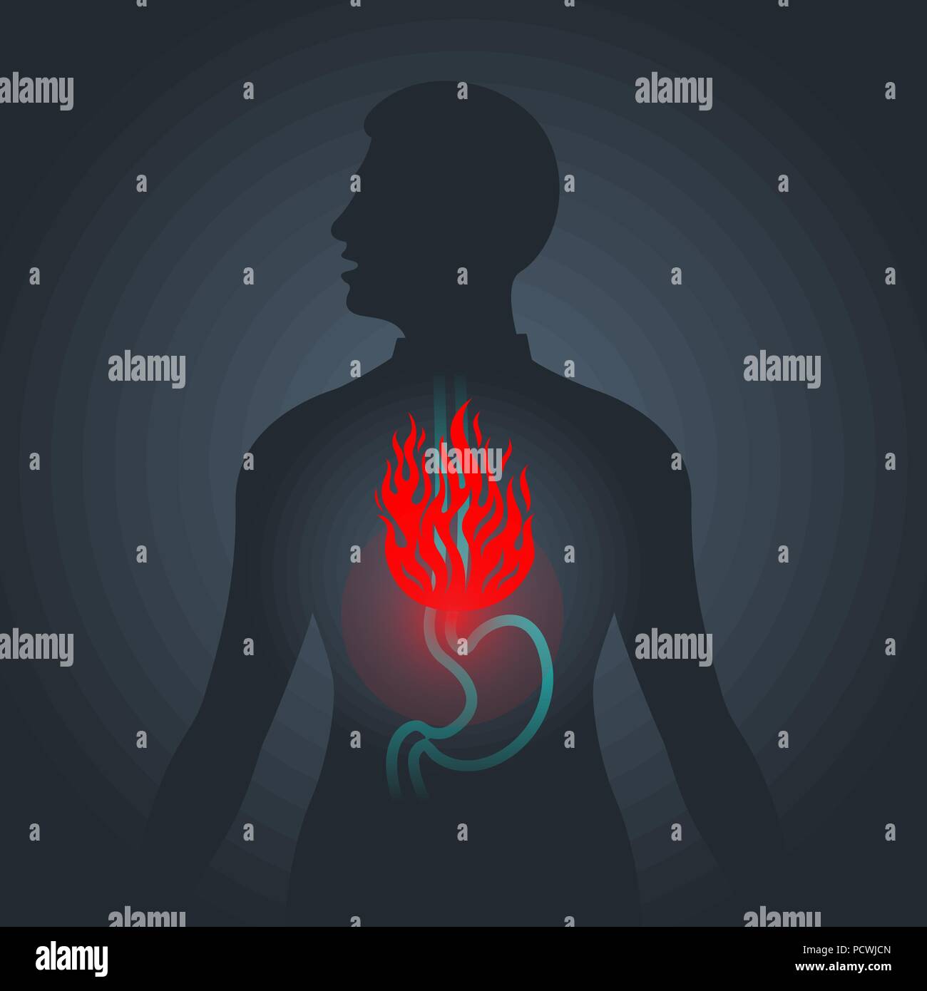 Dyspepsia vector logo icon illustration Stock Vector Image & Art - Alamy