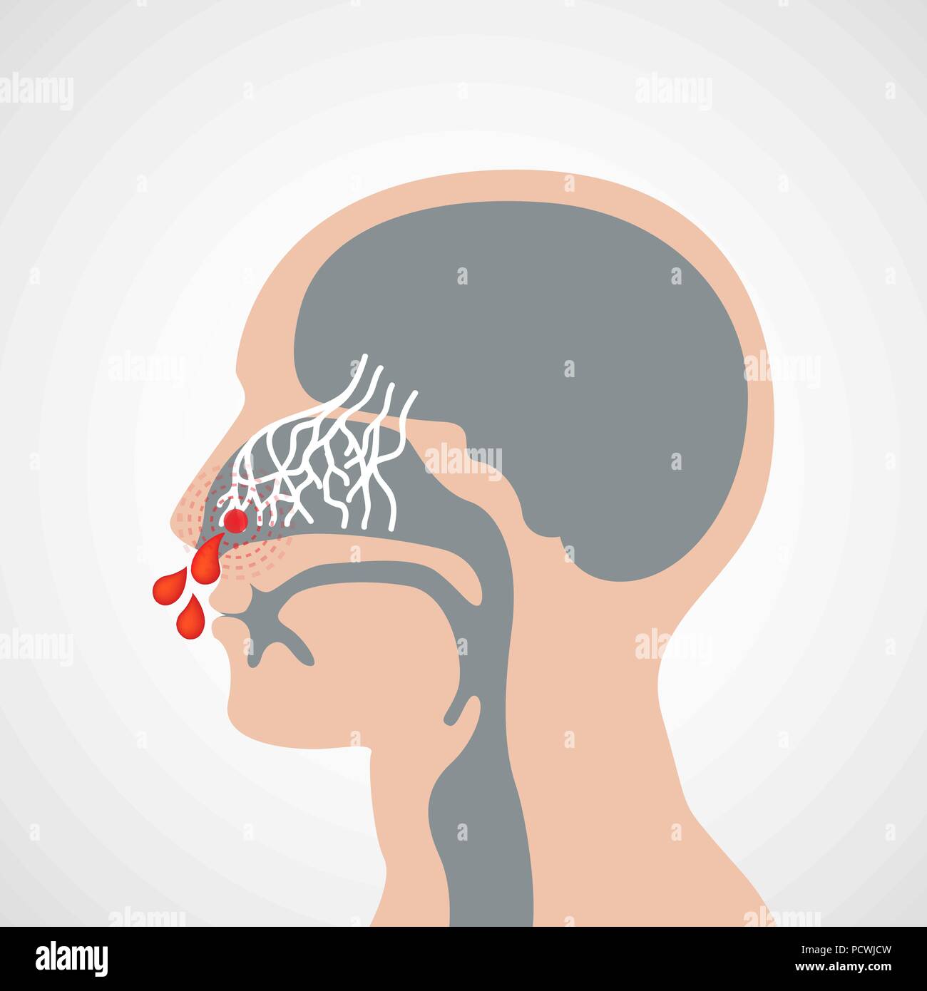 Epistaxis vector logo icon illustration Stock Vector Image & Art - Alamy