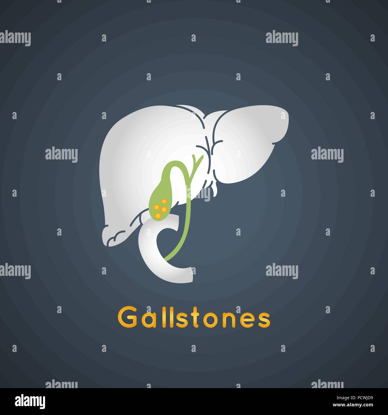 Gallstone vector logo icon illustration Stock Vector Image & Art - Alamy