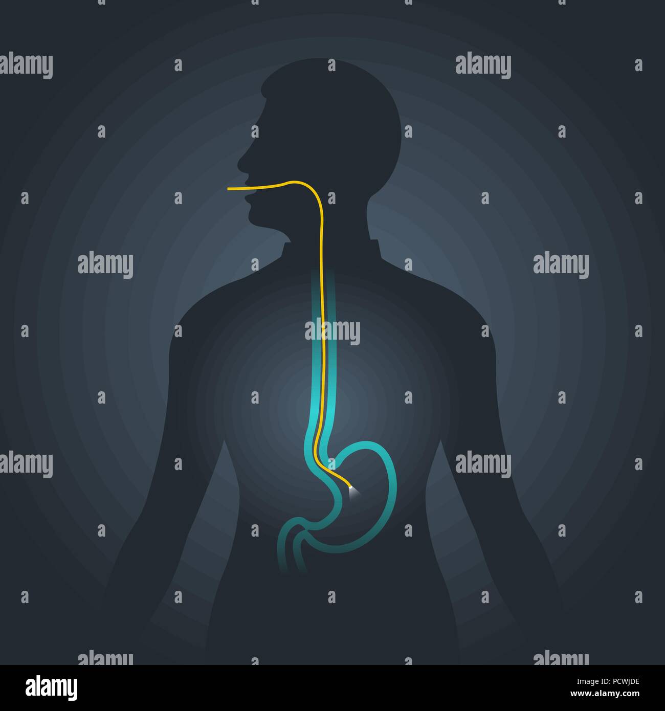Gastroscopy stomach Stock Vector Images - Alamy