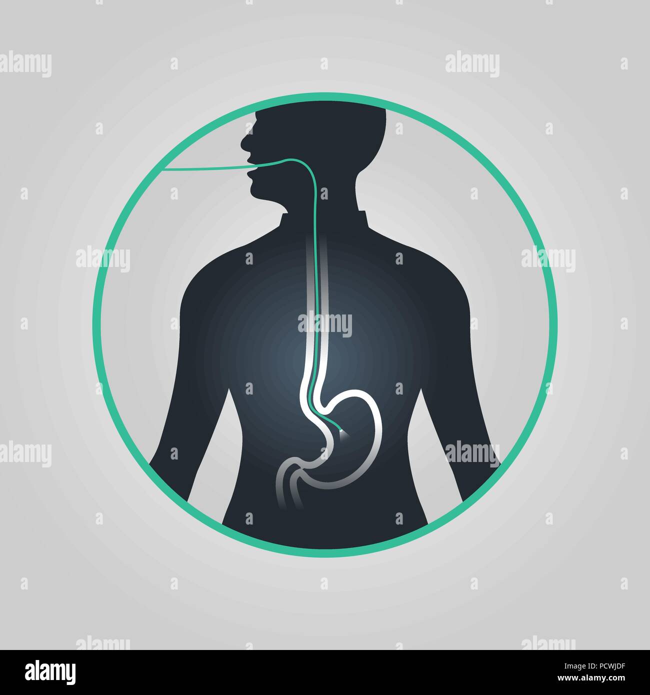 Gastroscopy stomach Stock Vector Images - Alamy