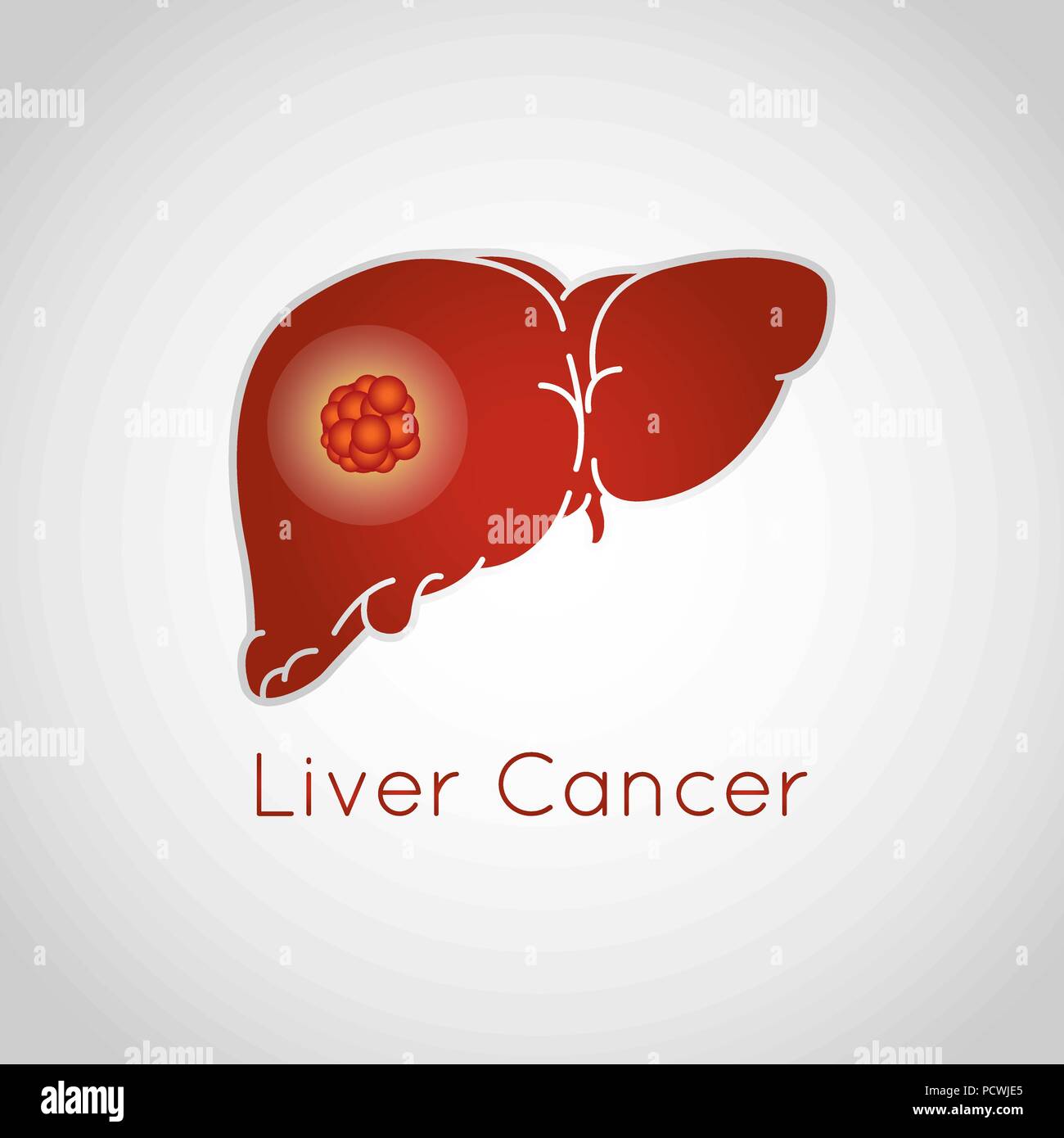 Liver Cancer vector logo icon illustration Stock Vector Image & Art - Alamy