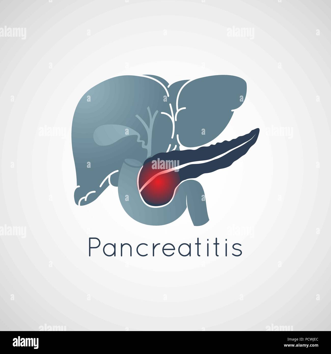 Pancreatitis hi-res stock photography and images - Alamy