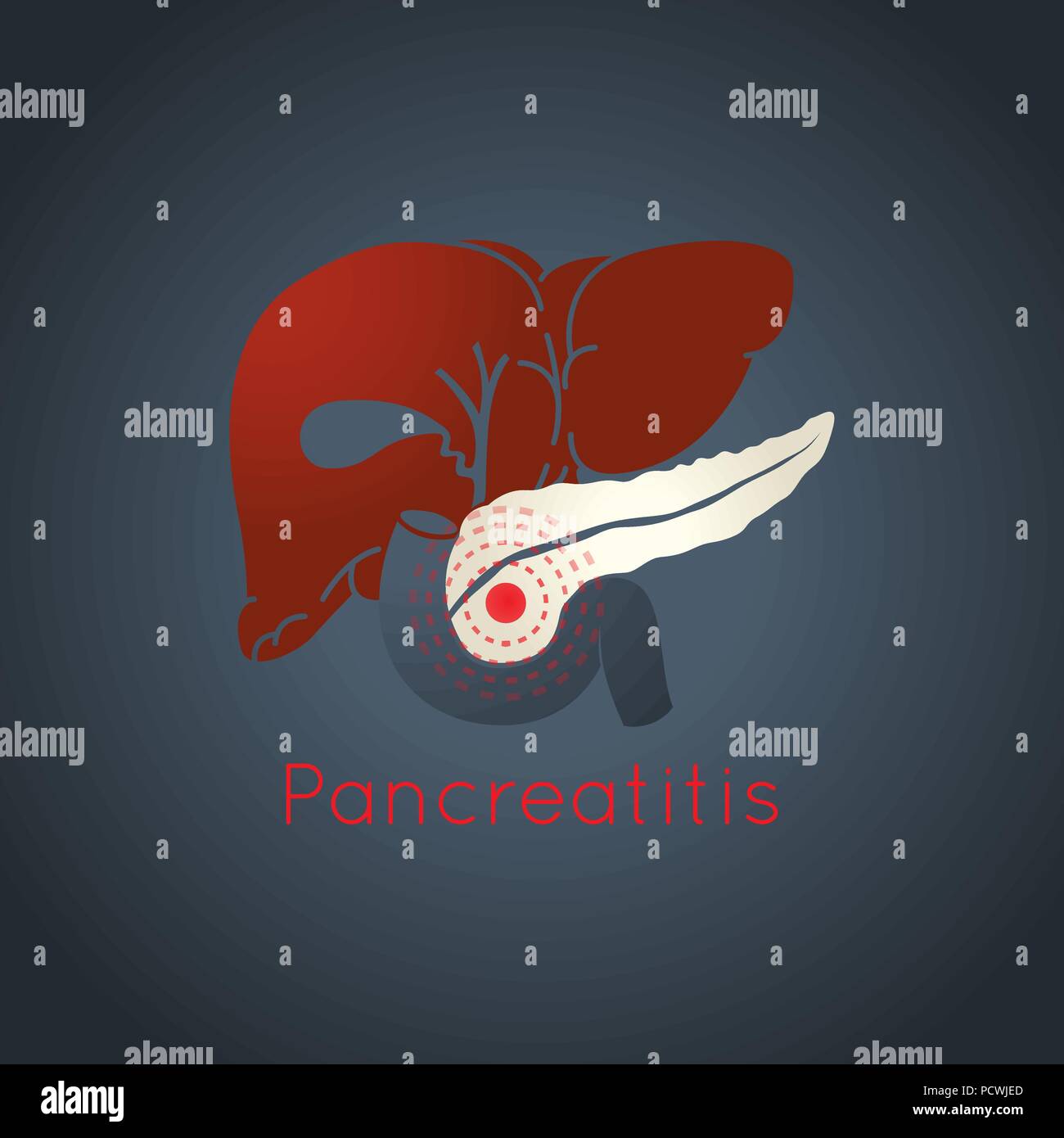 Pancreatitis hi-res stock photography and images - Alamy