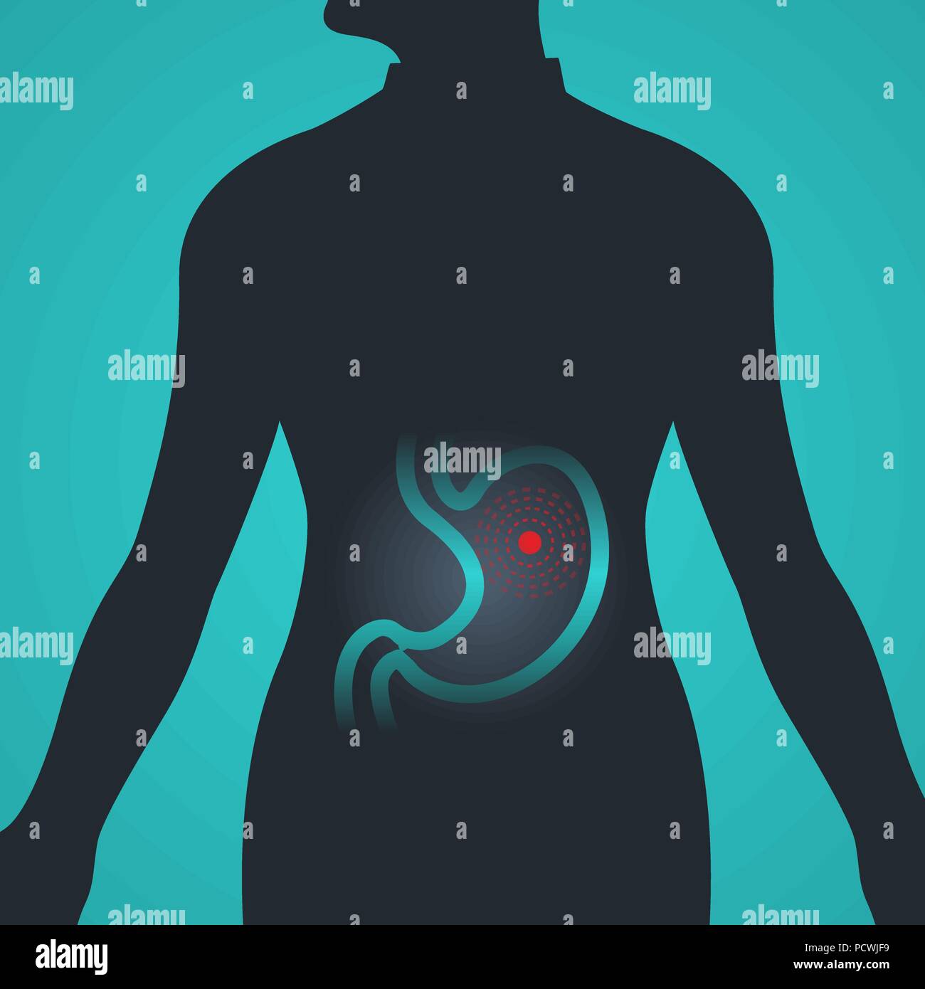 Stomach Cancer vector logo icon illustration Stock Vector Image & Art ...