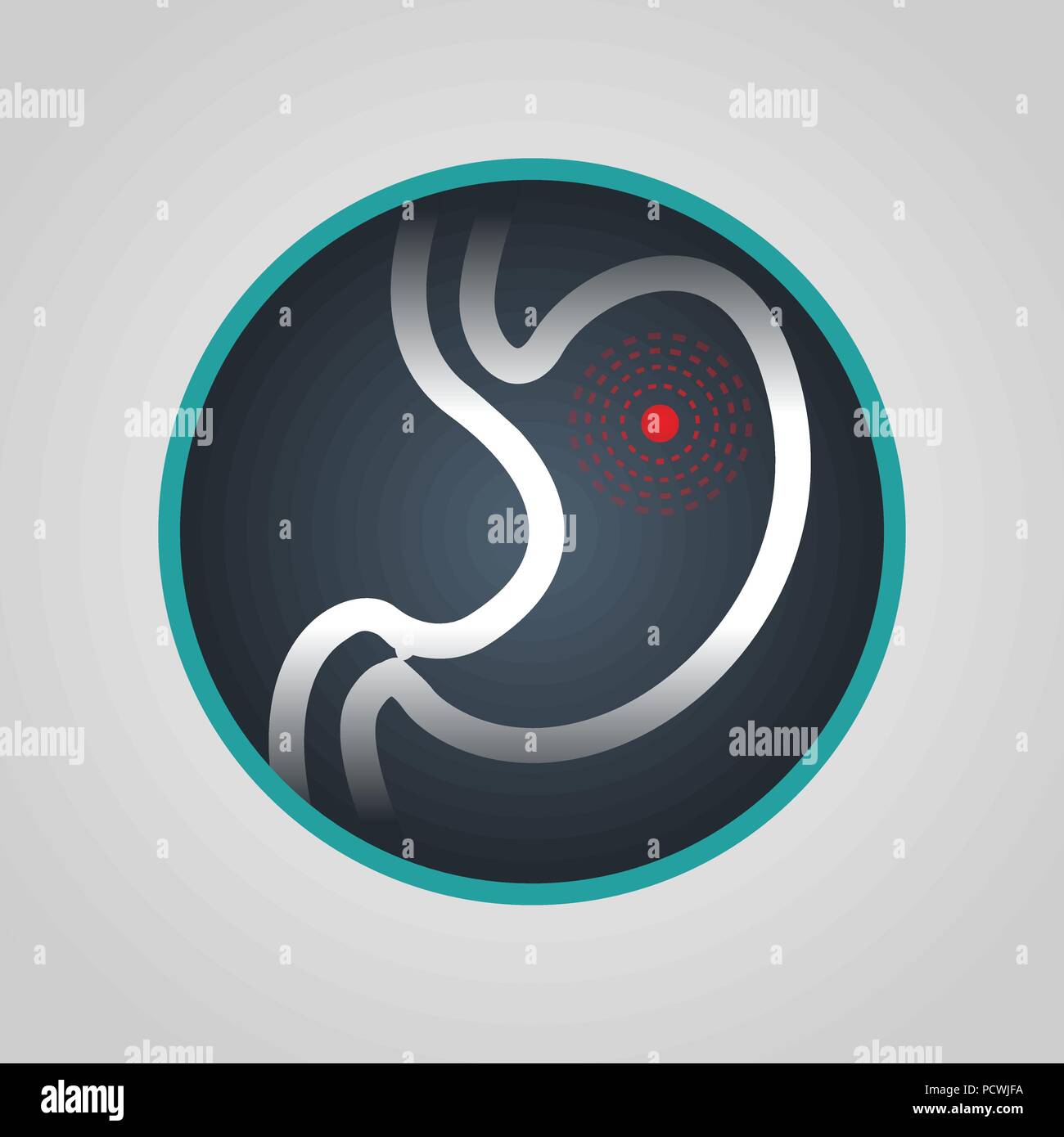 Stomach cancer hi-res stock photography and images - Alamy