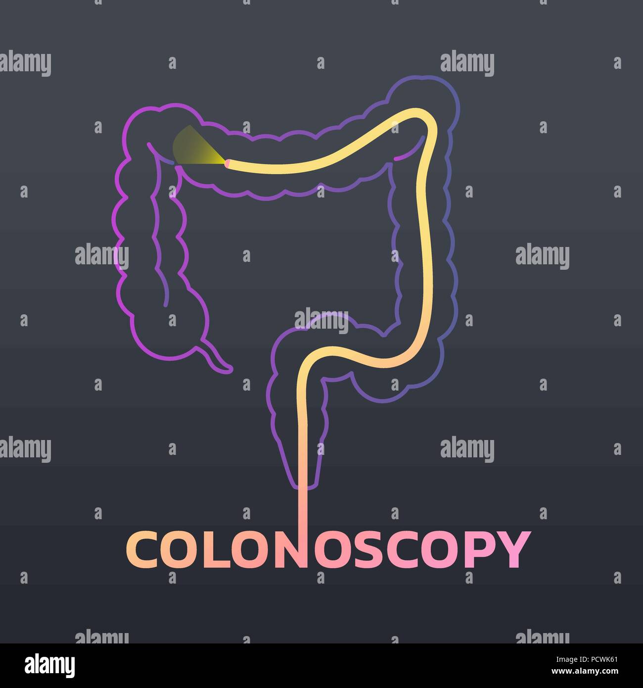 Colonoscopy High Resolution Stock Photography and Images - Alamy