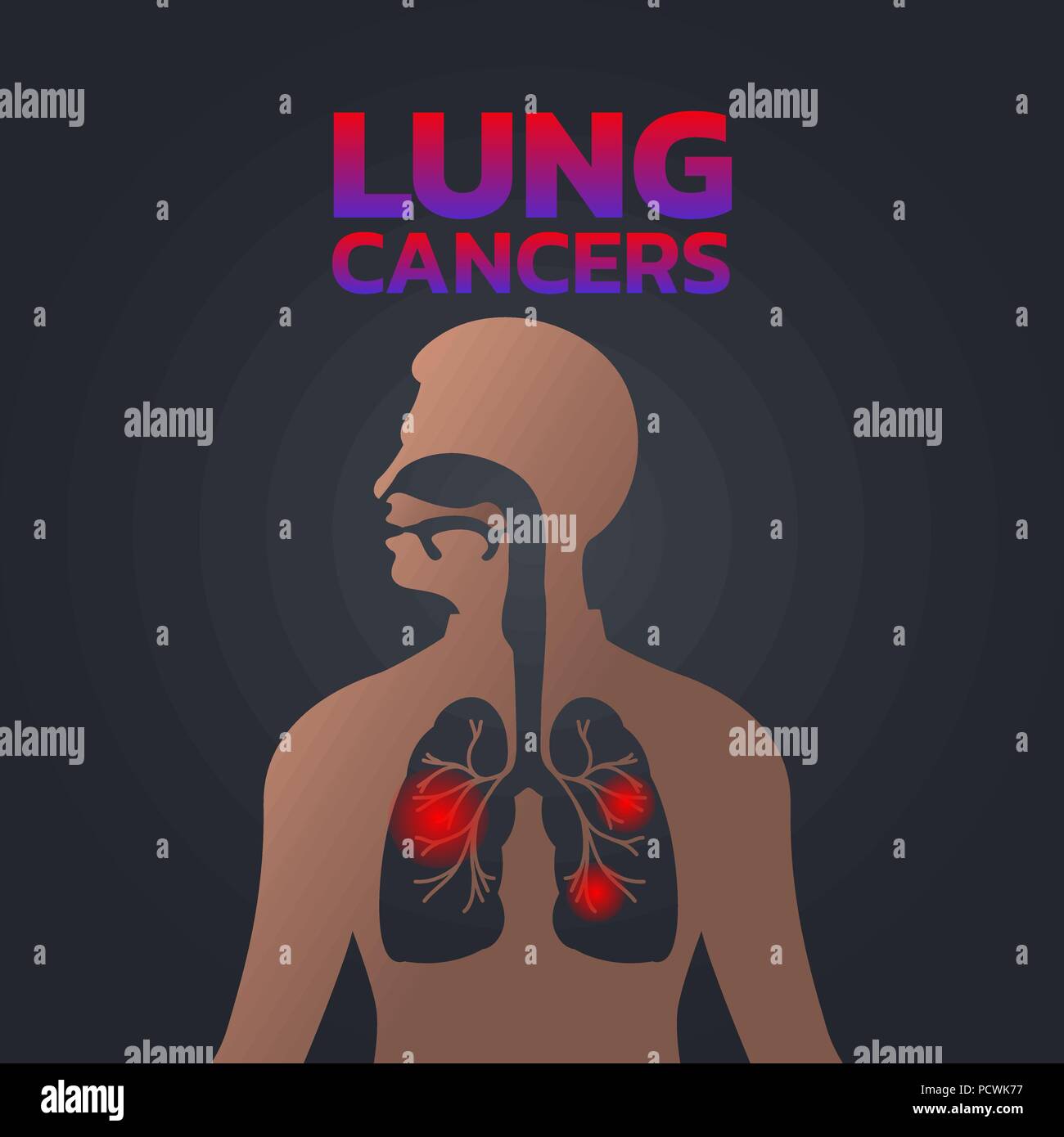 lung cancers icon design, infographic health, medical infographic ...