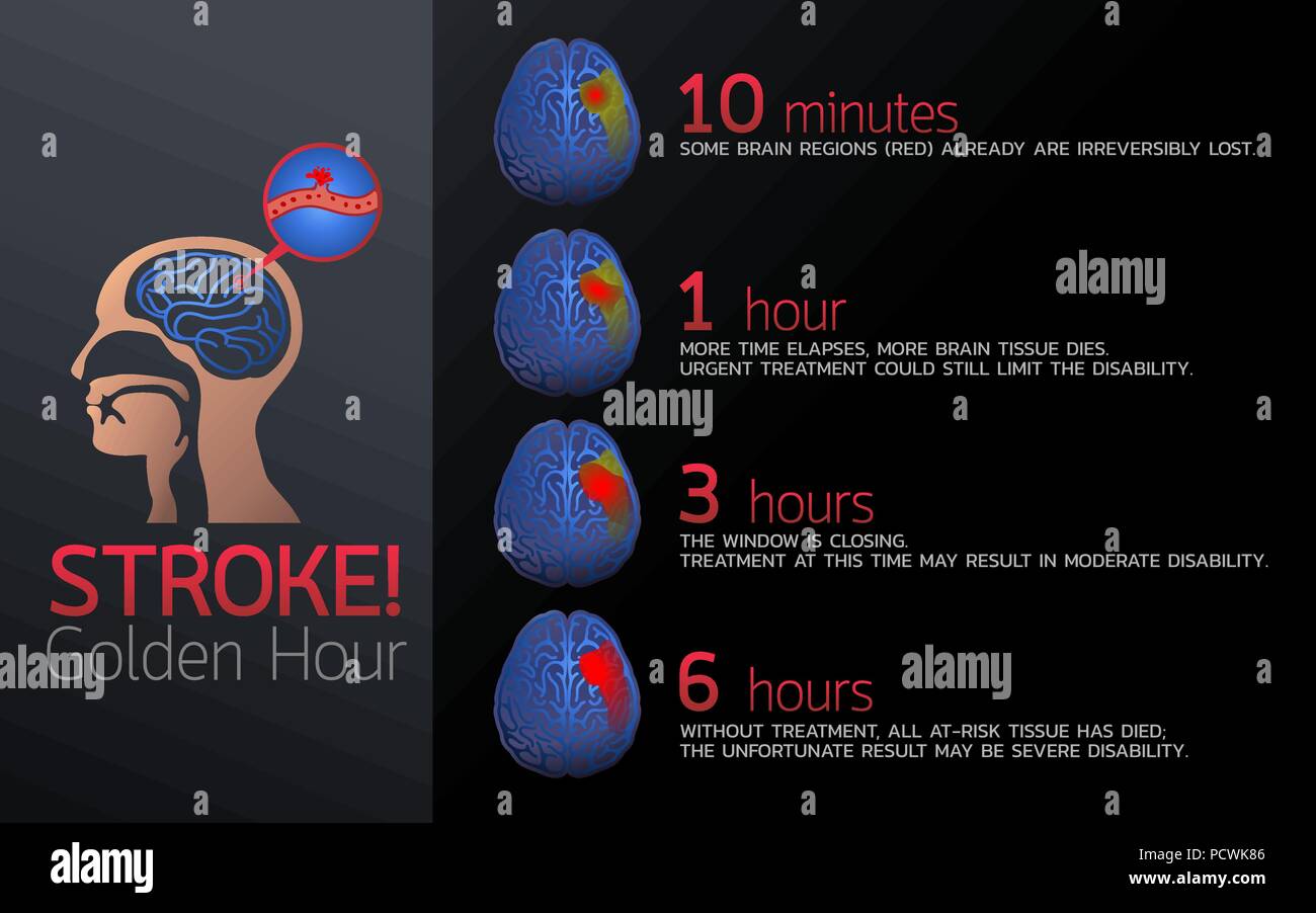 stroke Golden Hour icon design, infographic health, medical infographic ... stroke Golden Hour icon design, infographic health, medical infographic ...