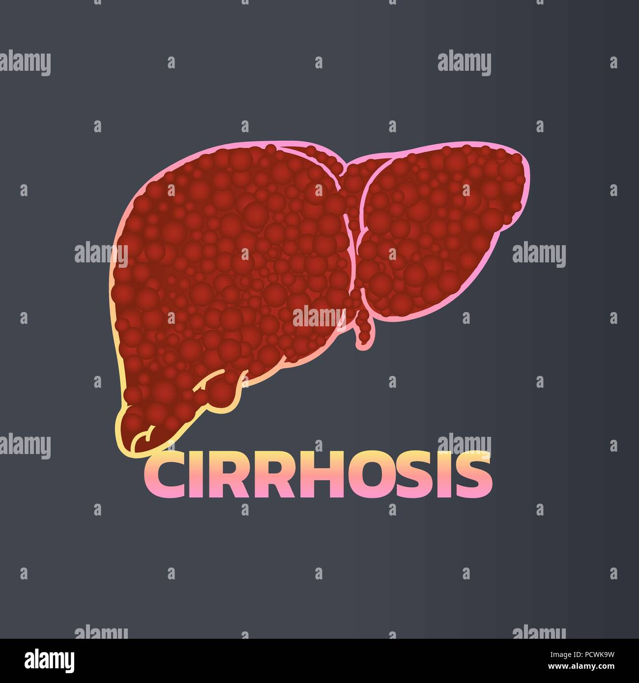 cirrhosis icon design, infographic health, medical infographic. Vector ...