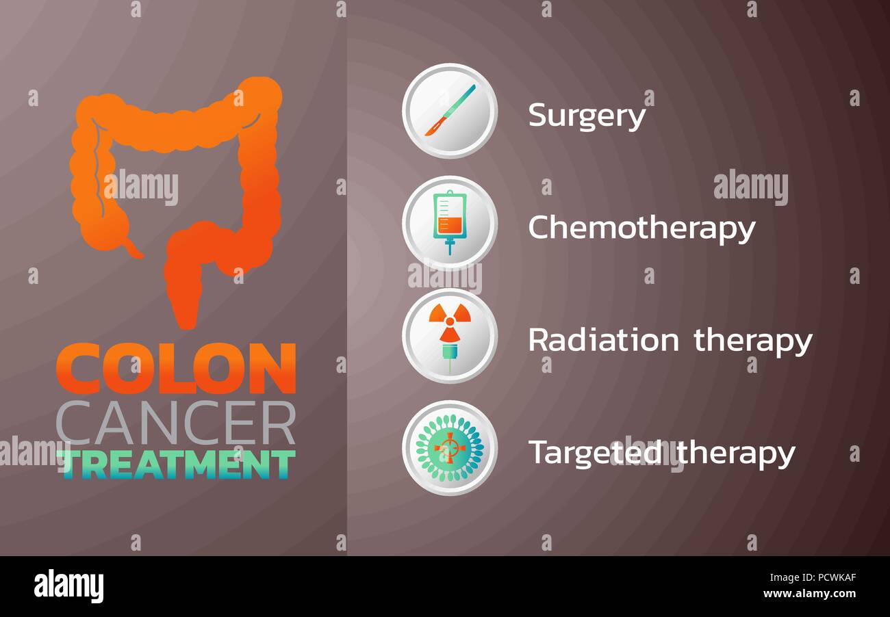 Colorectal Cancer Stock Photos & Colorectal Cancer Stock Images - Alamy