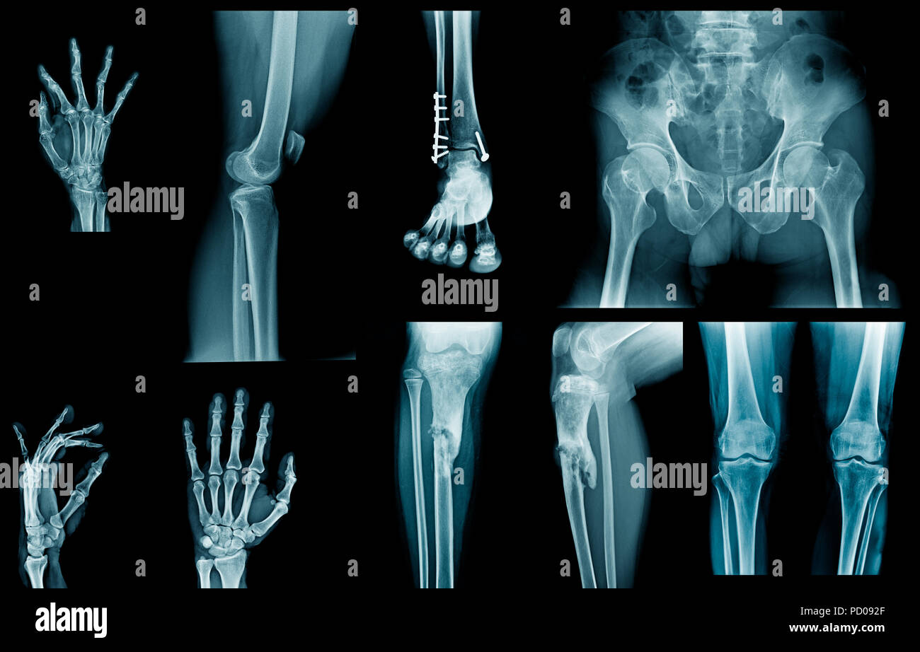 collection x-ray in blue tone Stock Photo - Alamy