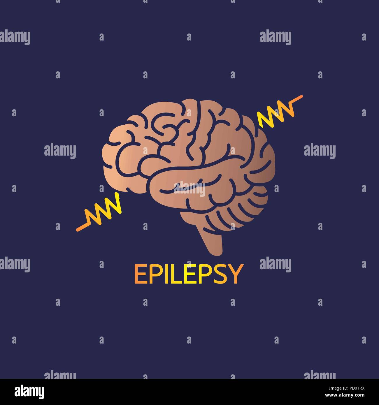 Epilepsy Brain Stock Photos & Epilepsy Brain Stock Images - Alamy