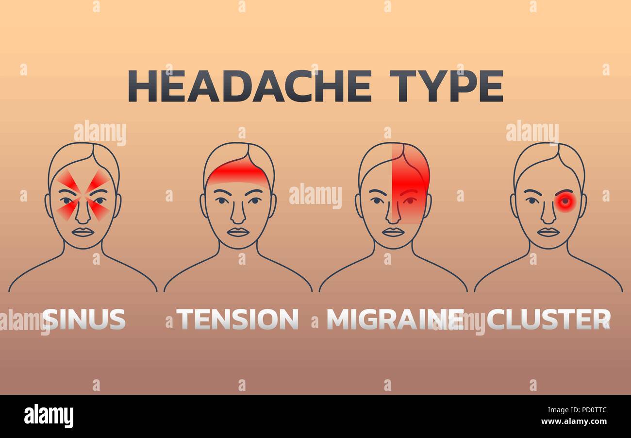 Types of Headaches Infographics design template, icon vector ...