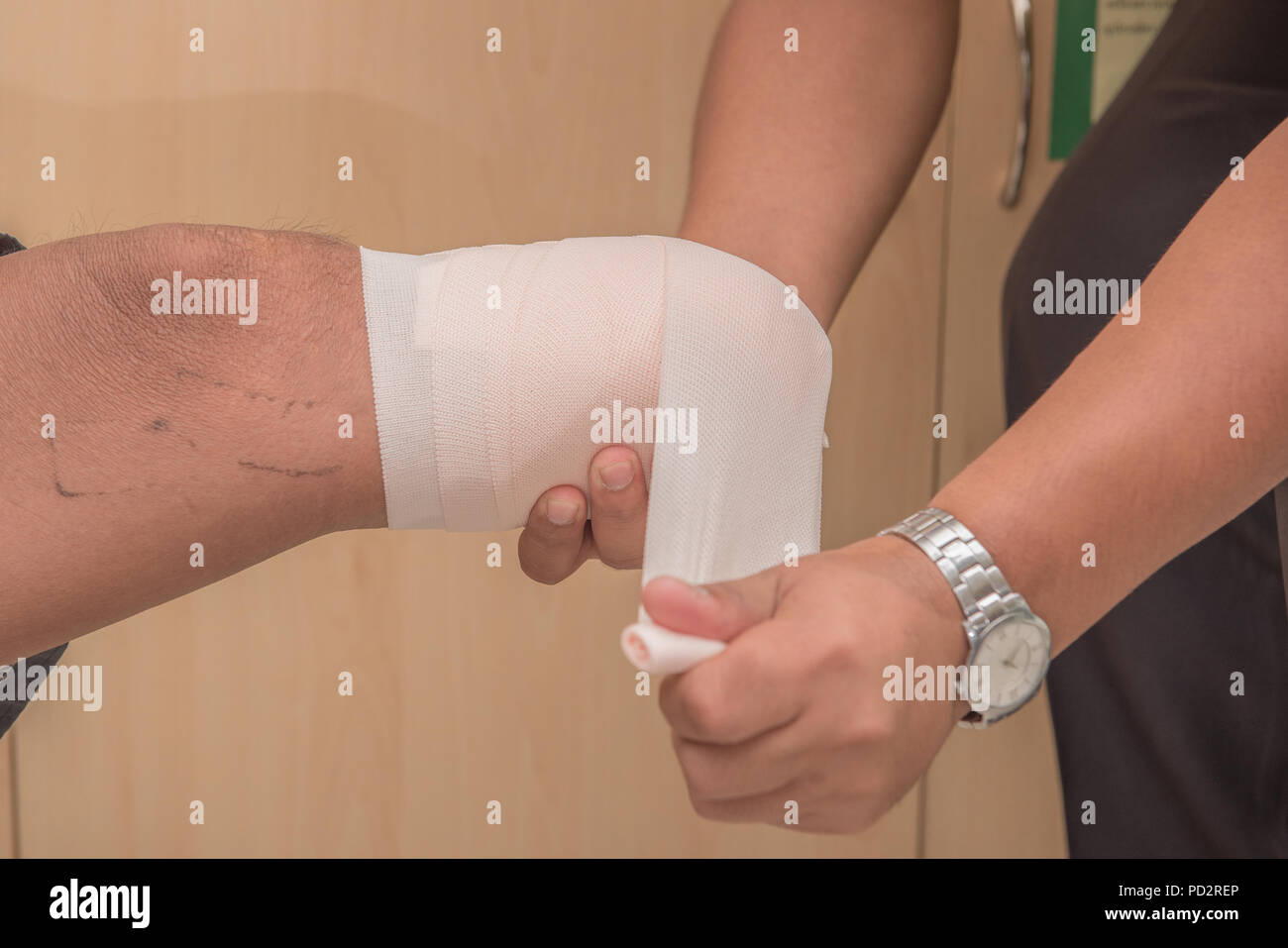 below knee stump bandaging, amputee BKA with prothesis preparing Stock ...