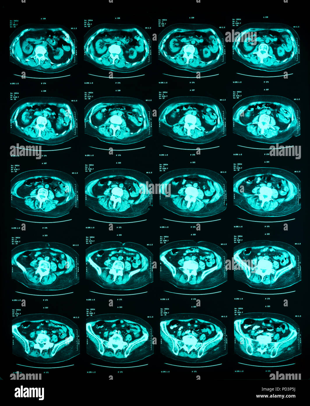 Sequence of horizontal sections of a female human brain, MRI scans, magnetic resonance imaging ...