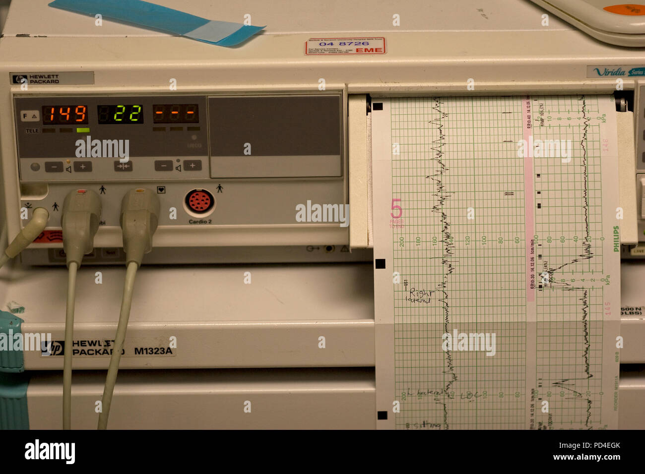 Nhs heart monitor hi-res stock photography and images - Alamy