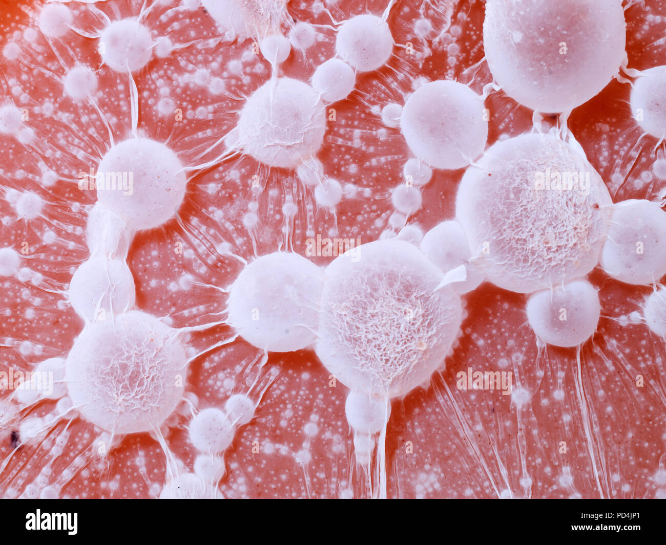 Tumour Cells High Resolution Stock Photography and Images - Alamy