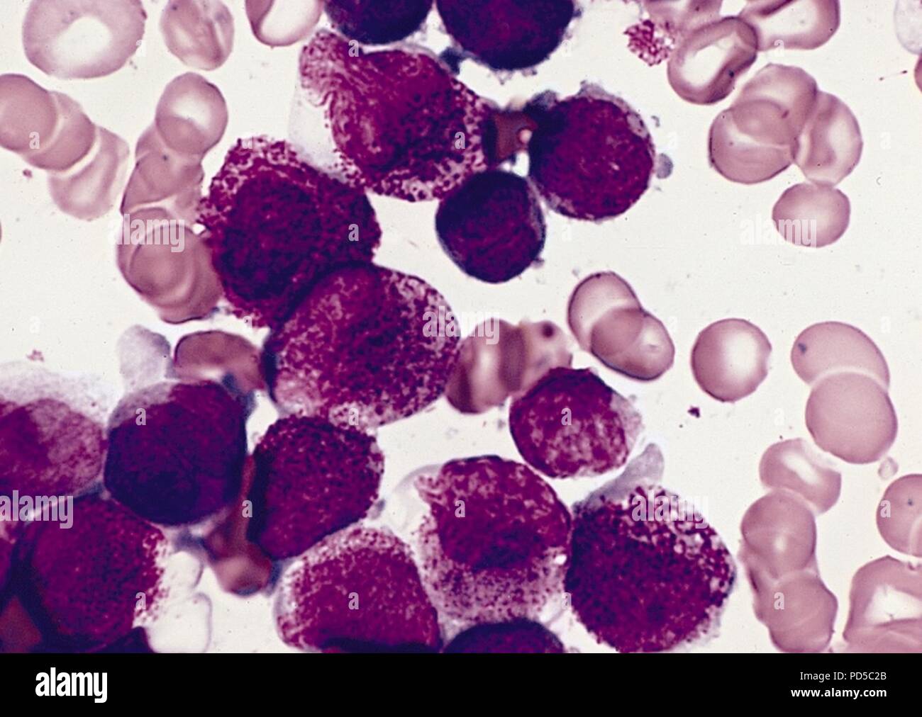 Aml image hi-res stock photography and images - Alamy