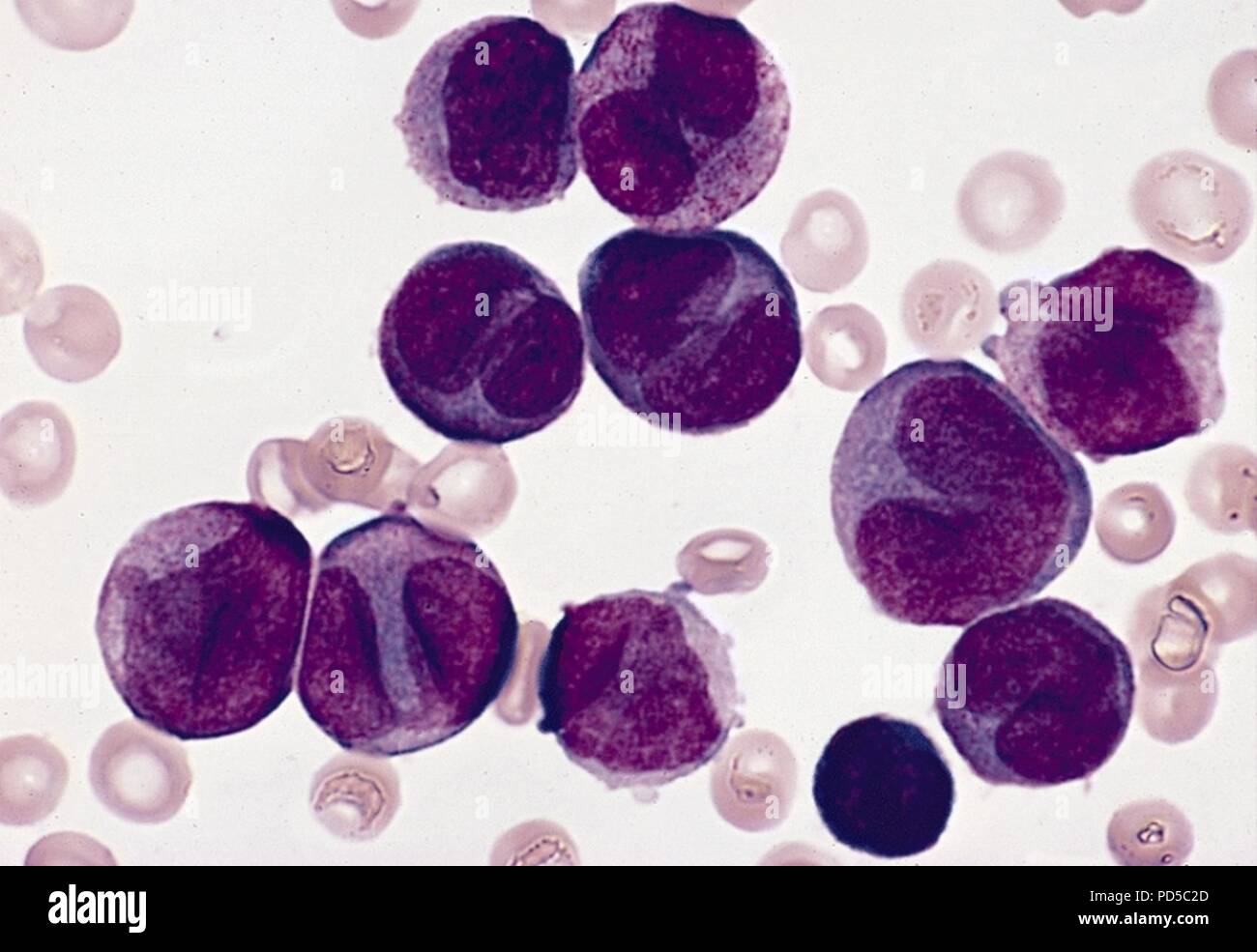 Aml image hi-res stock photography and images - Alamy