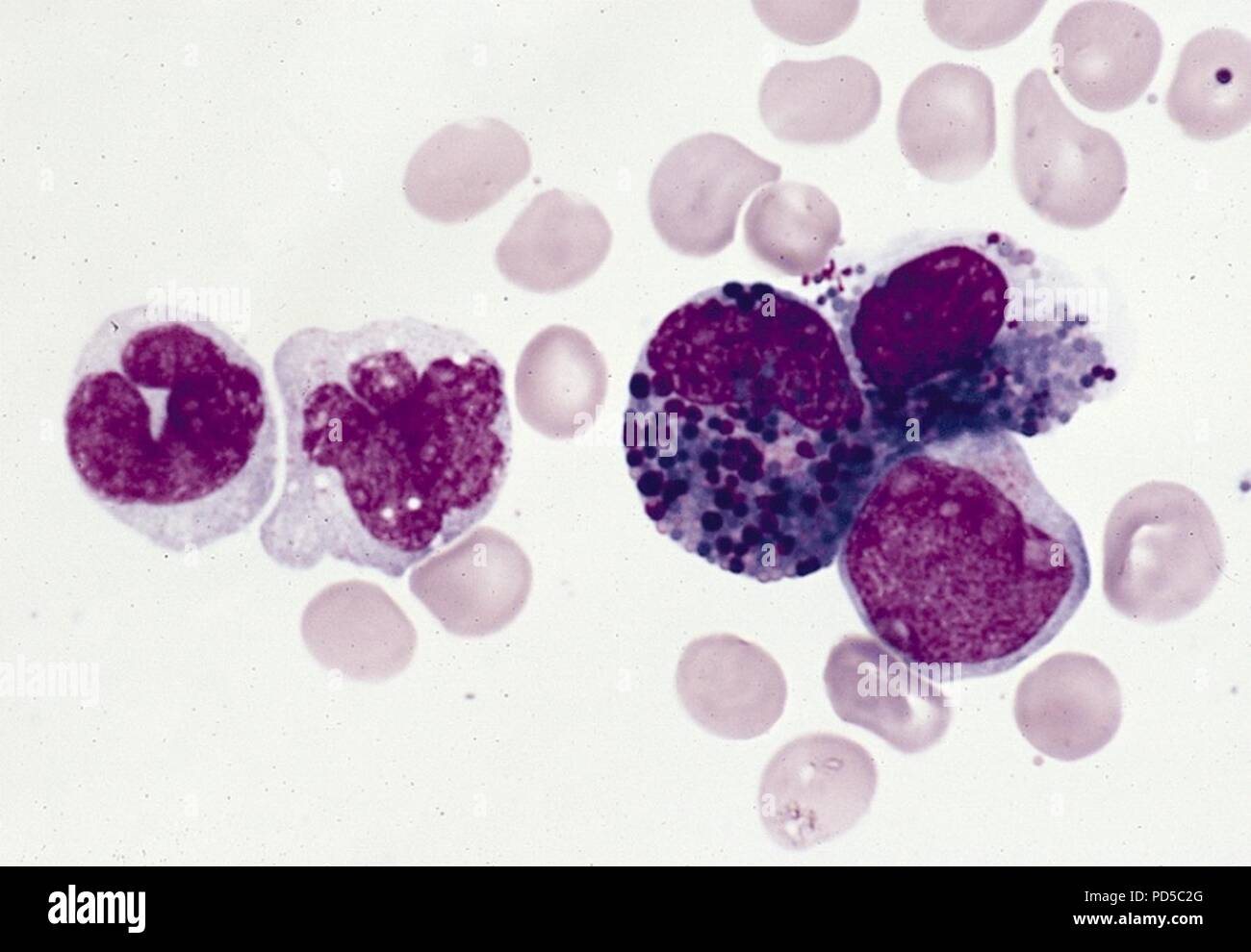 Aml image hi-res stock photography and images - Alamy