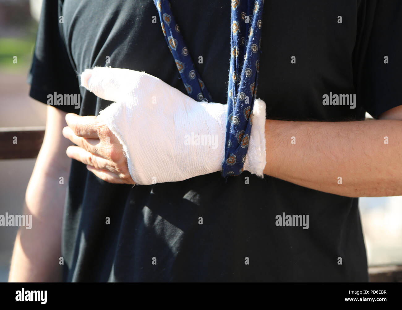 man after the incident with his arm around his neck and his hand ...