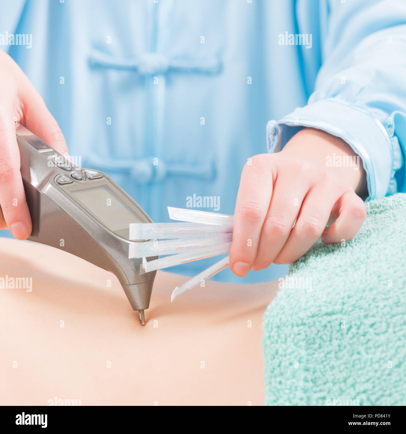 Finding an acupuncture point with electronic device which could be also ...