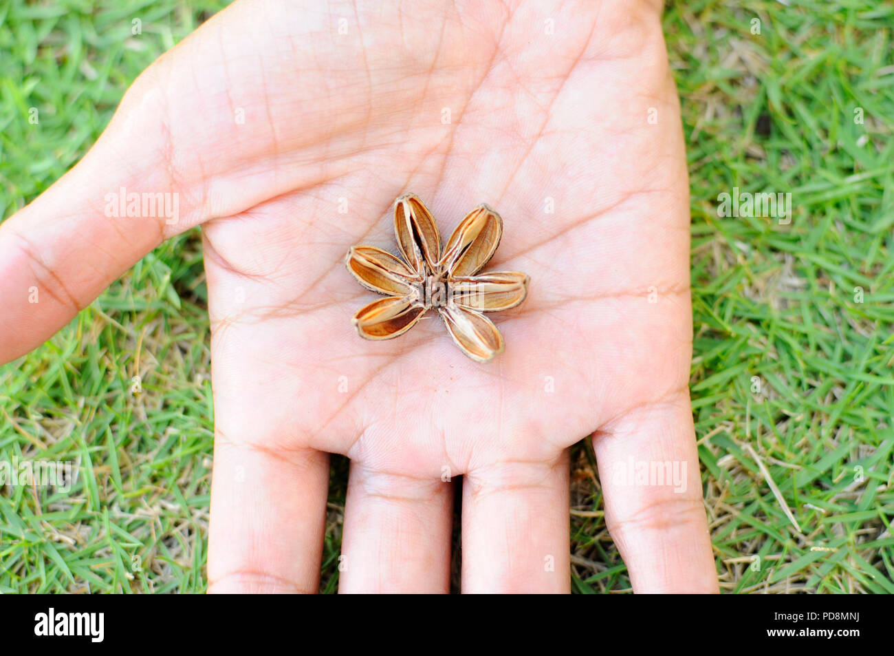 Missing thumb hi-res stock photography and images - Alamy