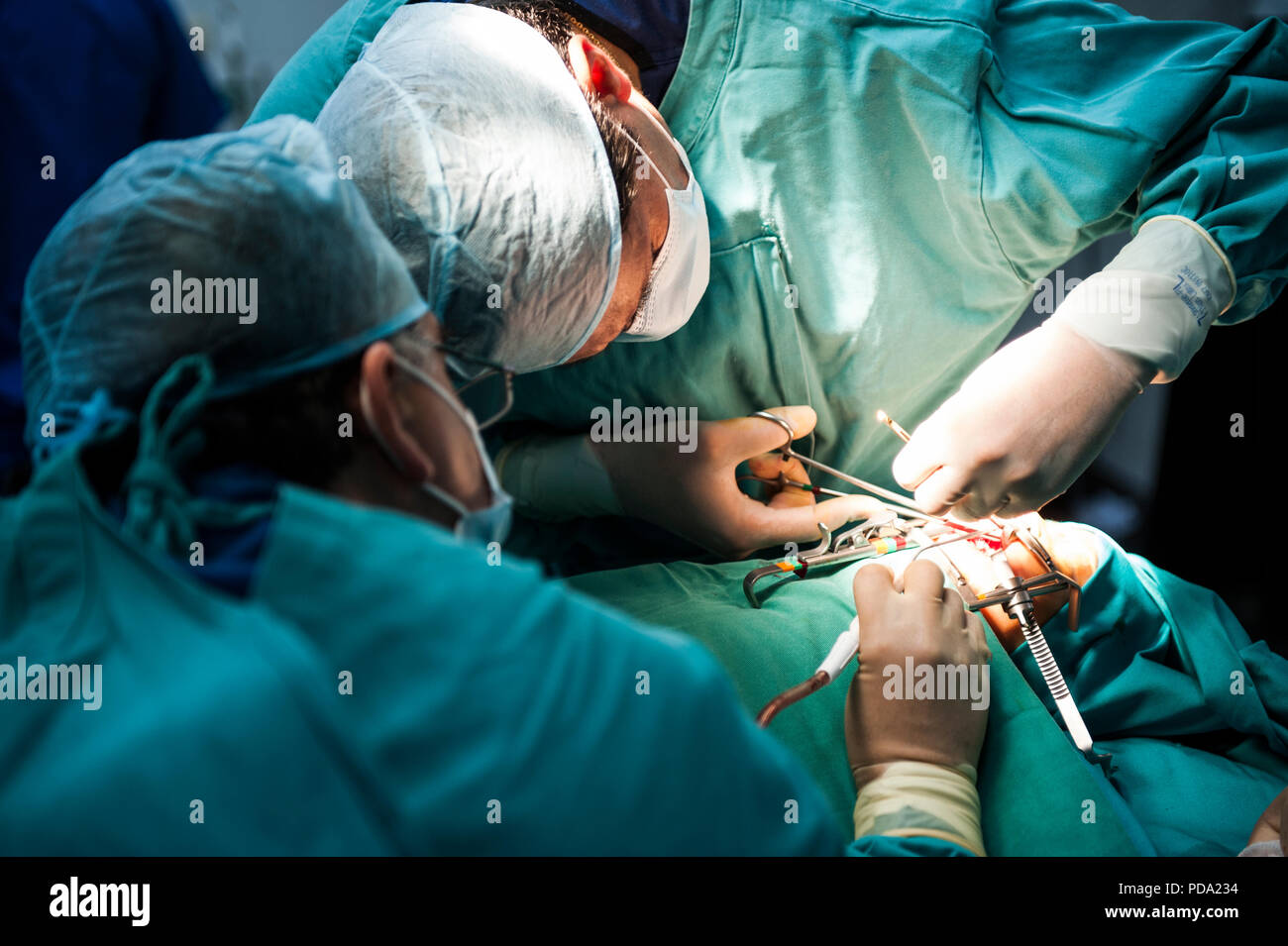 Team surgeon at work in operating room Stock Photo - Alamy