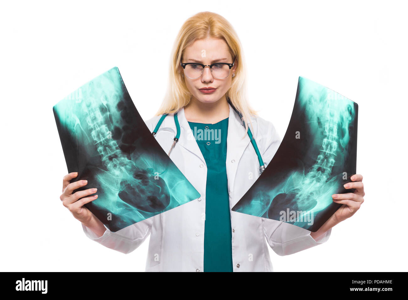Woman doctor with X-rays Stock Photo - Alamy