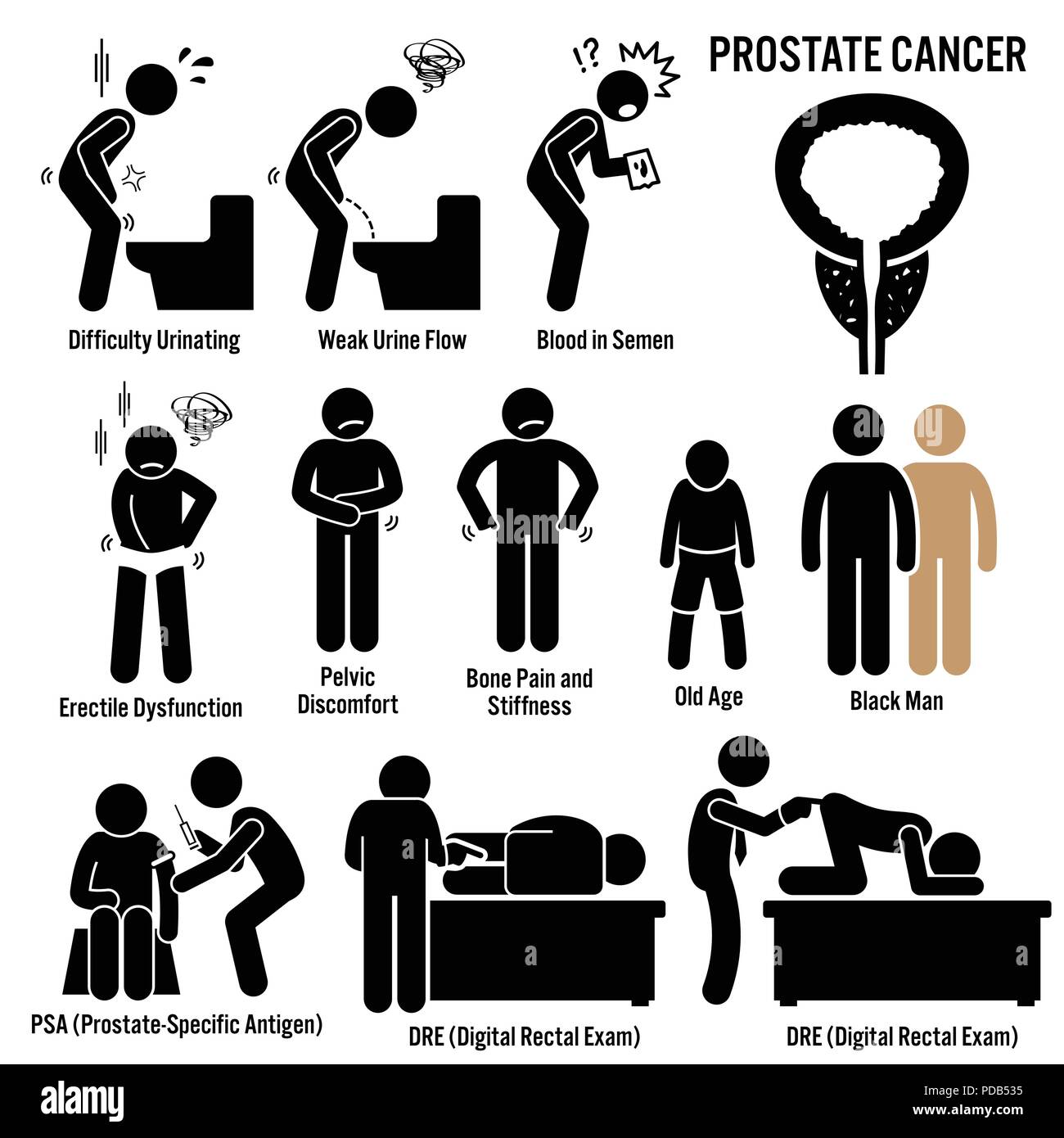 Prostate Cancer Symptoms Causes Risk Factors Diagnosis Stick Figure ...