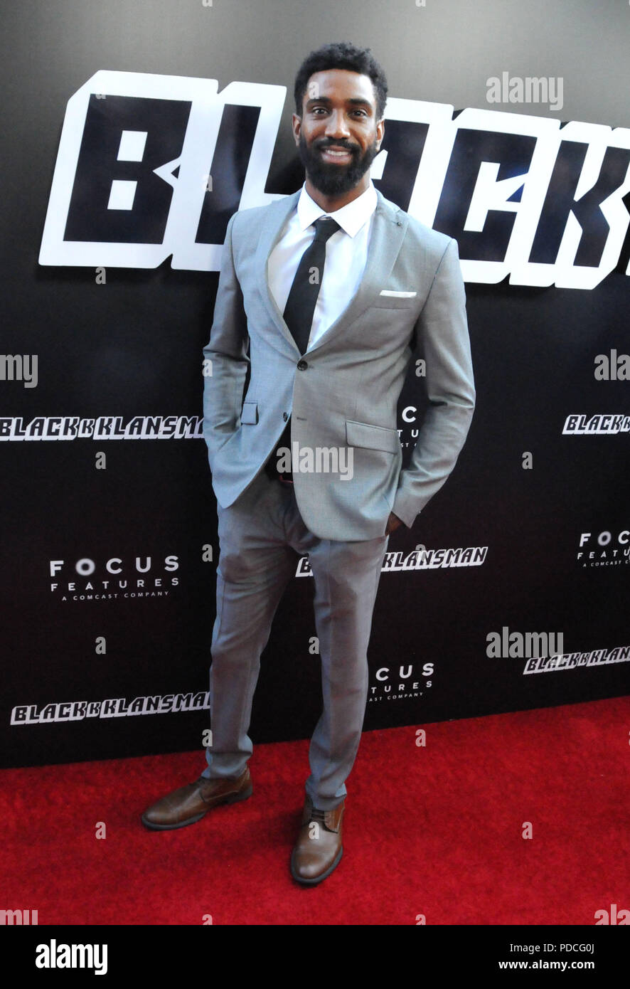 Cameron Howard Progeria