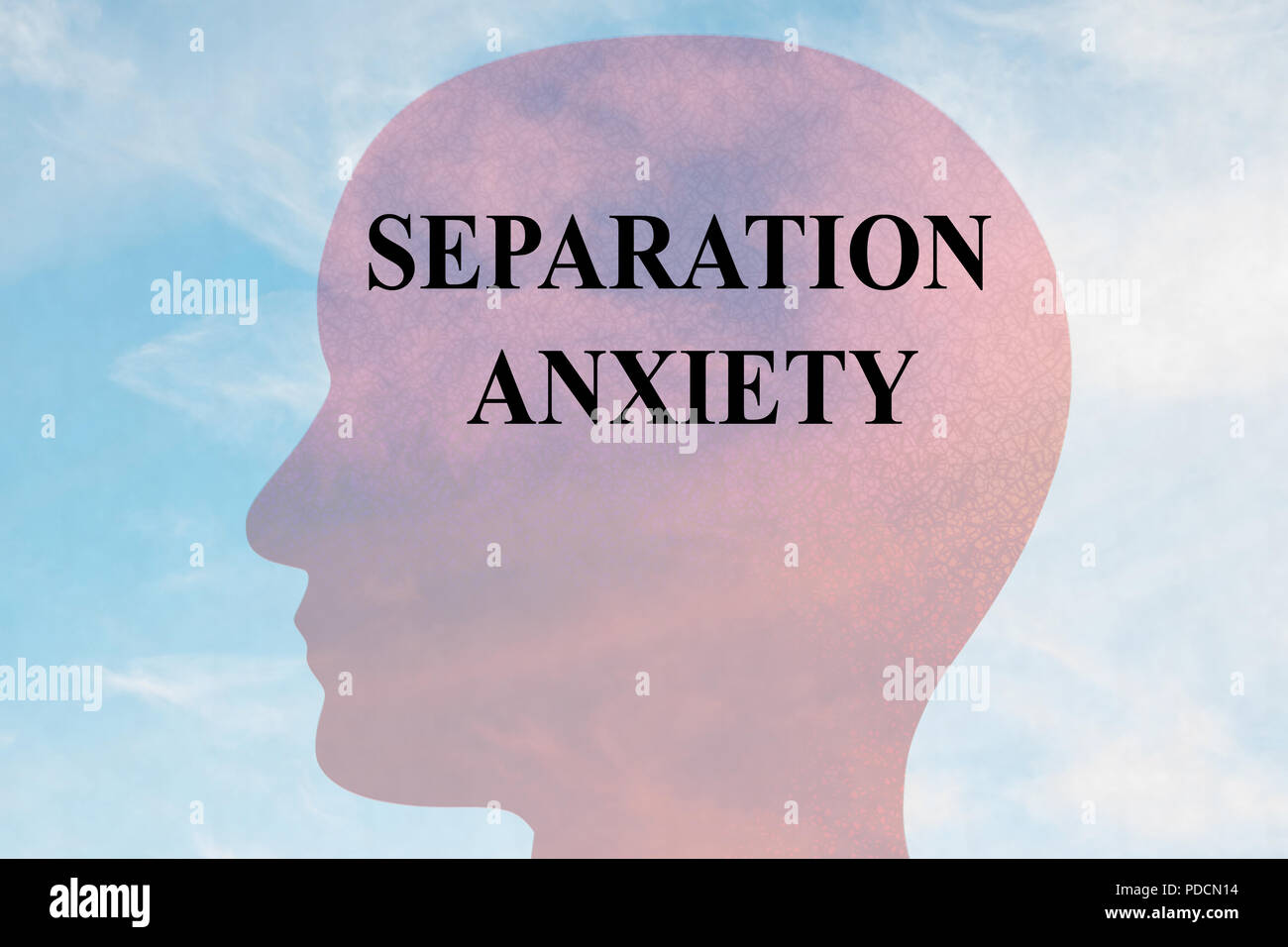 Render illustration of SEPARATION ANXIETY title on head silhouette ...
