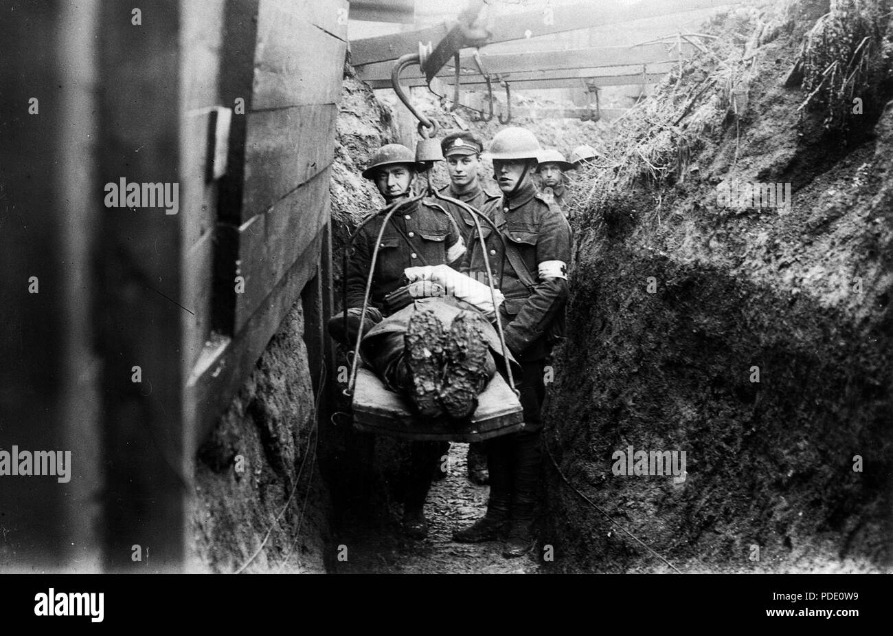 World war one injuries hi-res stock photography and images - Alamy