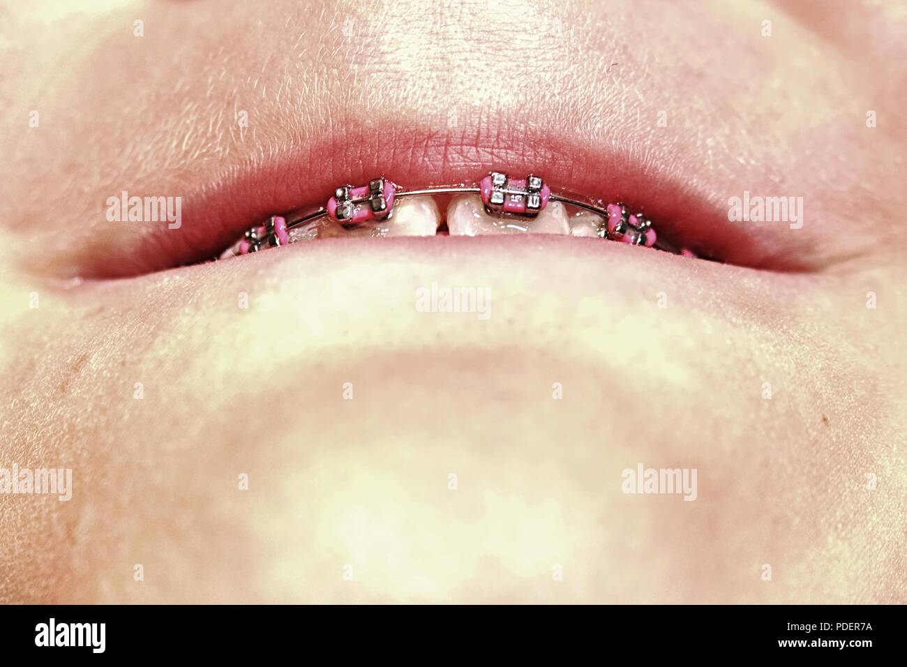 Rubbery grip hi-res stock photography and images - Alamy