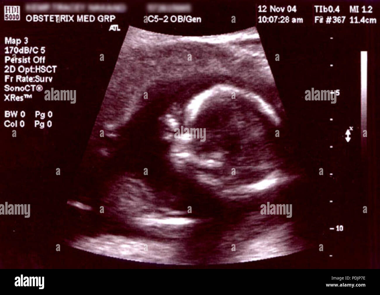 Ultrasonograph hi-res stock photography and images - Alamy