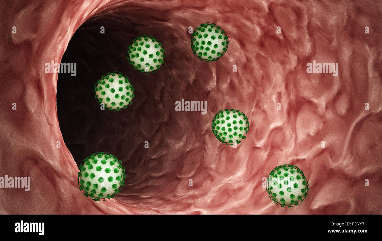 Virus Spread Inside The Body. Autoimmune Disease, Infection And ...