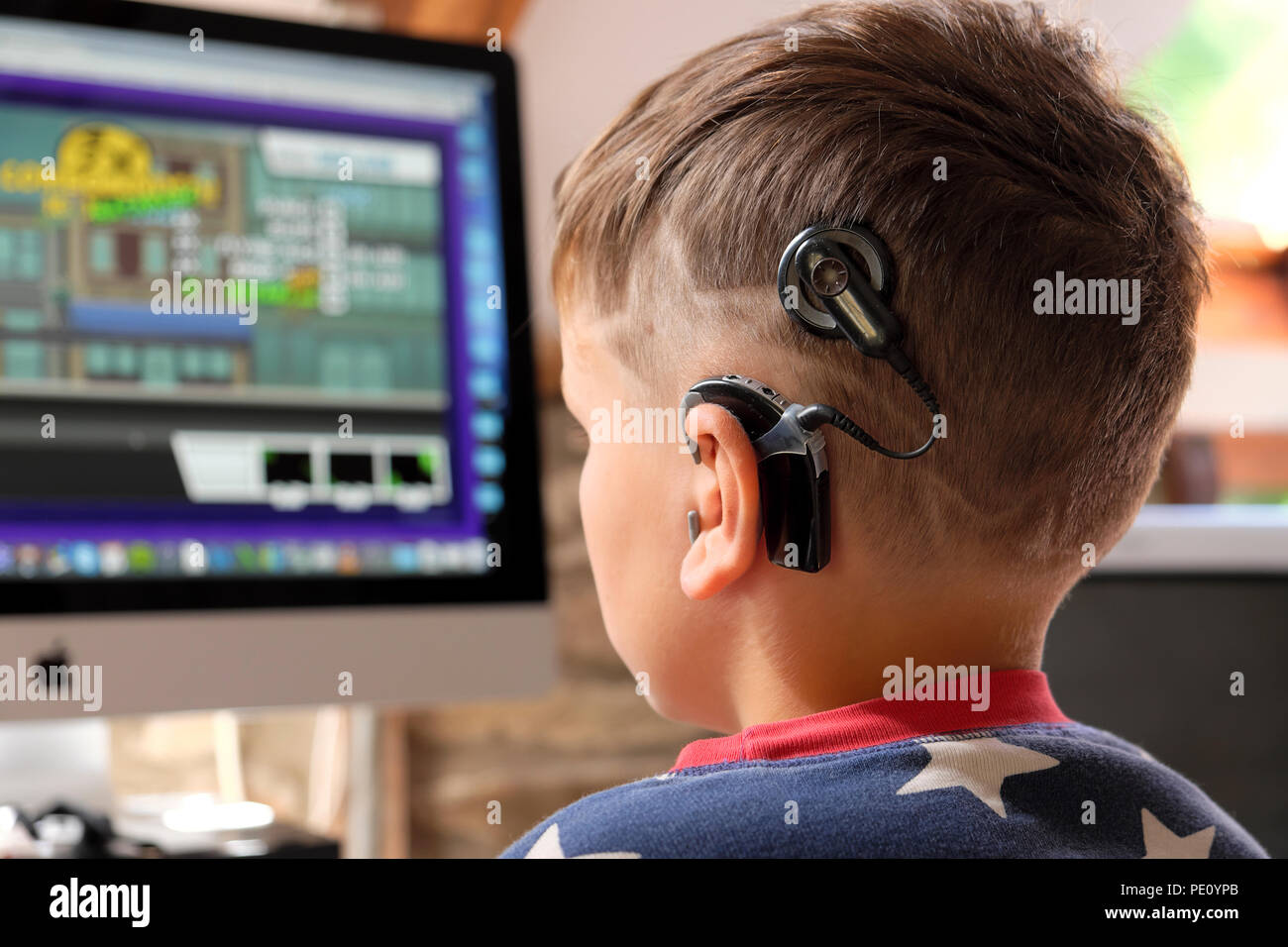 Child Hearing Aid High Resolution Stock Photography and Images - Alamy