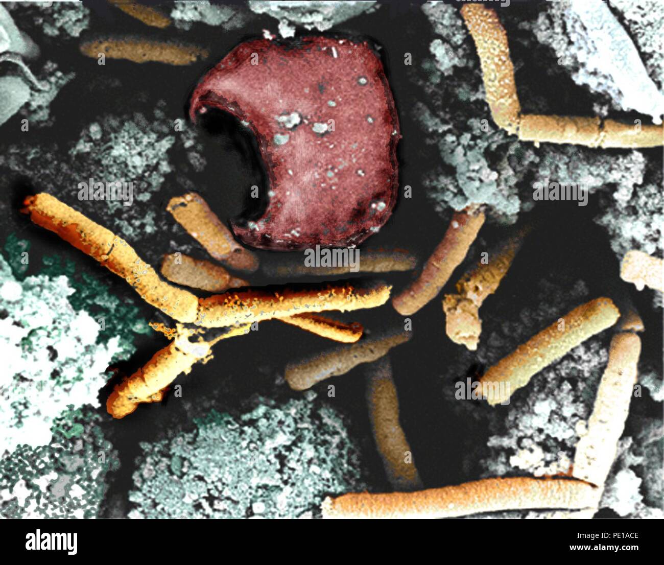 Anthrax color enhanced micrograph Stock Photo - Alamy