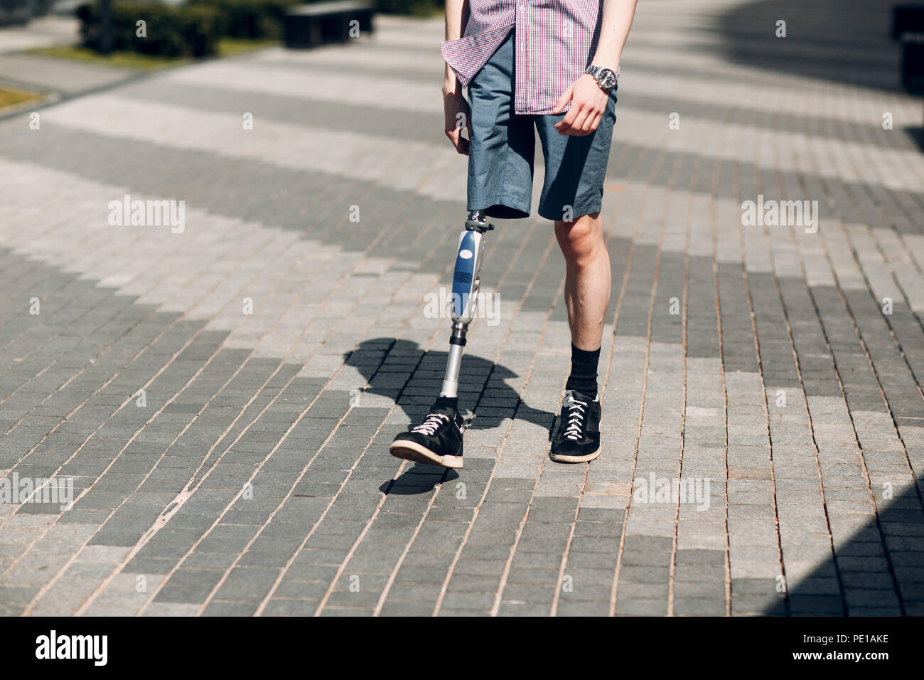 Disabled young man with foot prosthesis walks along the street Stock ...
